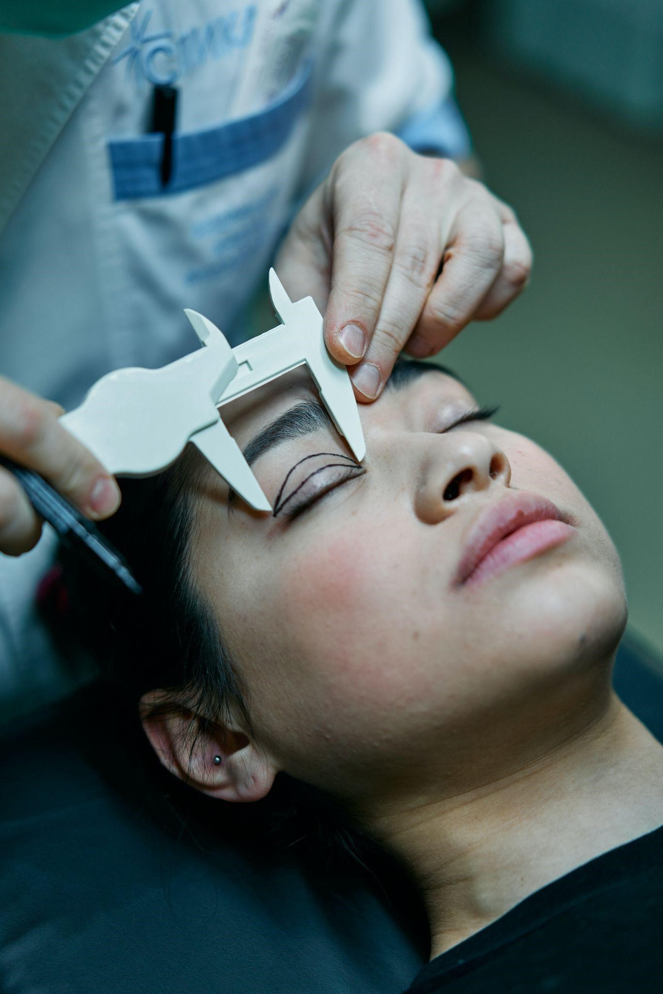Incisional Double Eyelid Surgery | SKETCH KOREA